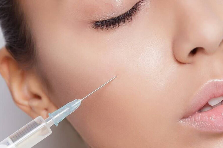 Calcium Hydroxylapatite (CaHA) Fillers: A Popular Non-Surgical